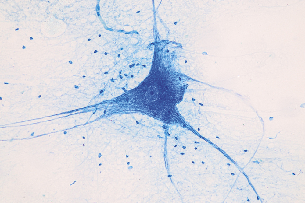 Zenuwpijn en polyneuropathie: Overeenkomsten en verschillen - Medisch ...